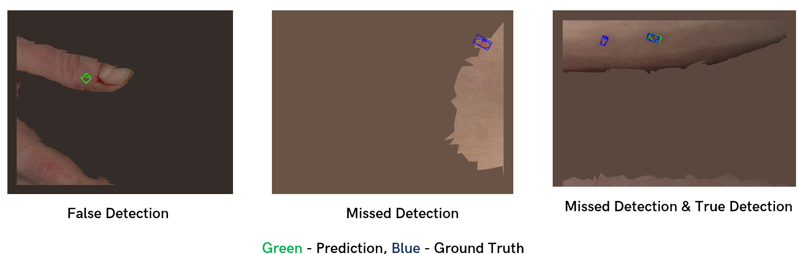 Pigmented-Skin-Lesion-Detection-in-Clinical-Images-Using-Deep-Learning ...